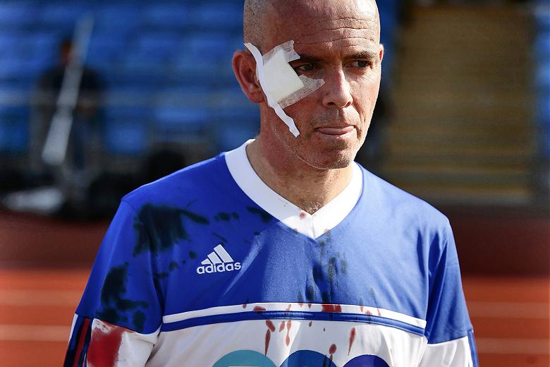 Northern Echo reporter bloodied after elbow from Ed Balls during pre ...