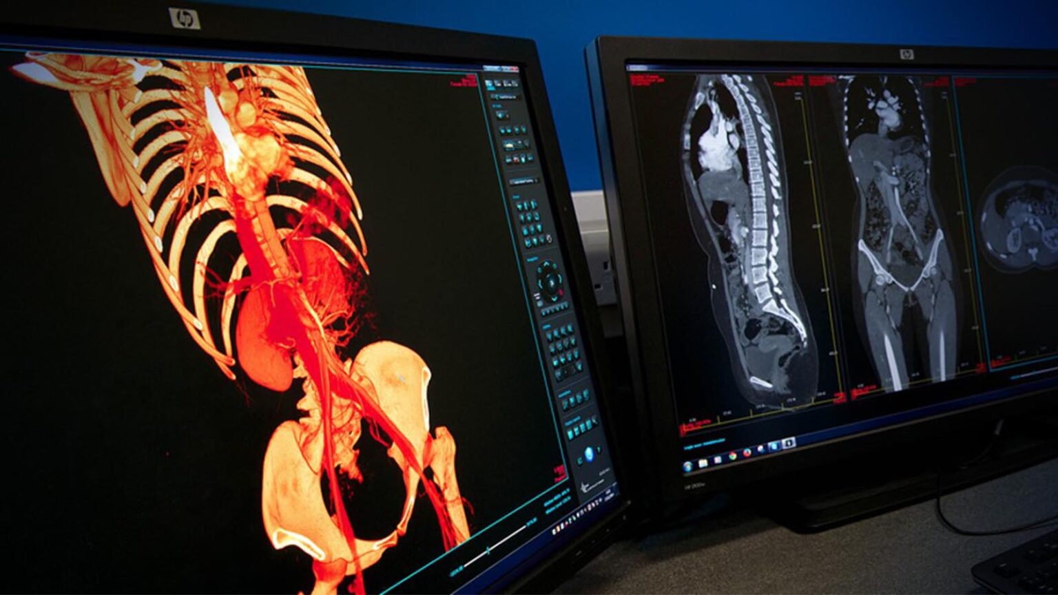 Digital Autopsy UK signs partnership with Bolton Council - Prolific North